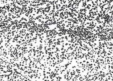 7ریز ساختار فولاد +تصاویر | متالورژی حامیران